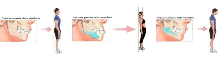 Cura occlusione e postura dentale - Masticazione - Studio Menegazzo